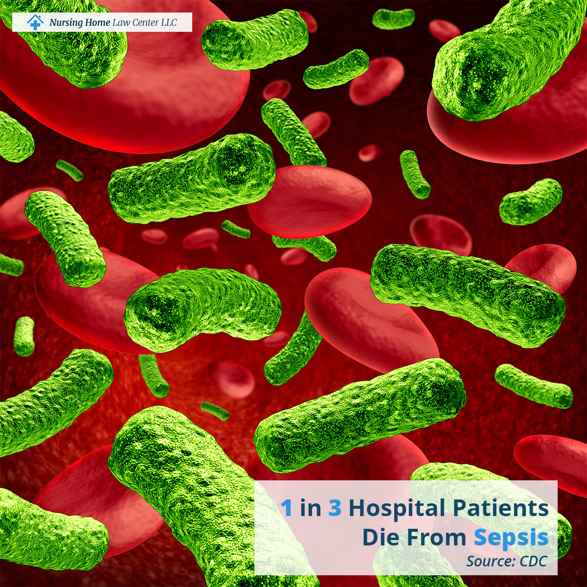 Sepsis in Nursing Homes Lawyer | Free Case Evaluation